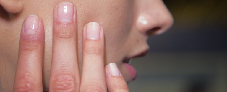 Causes Of Nail Detachment | Jacob Stack